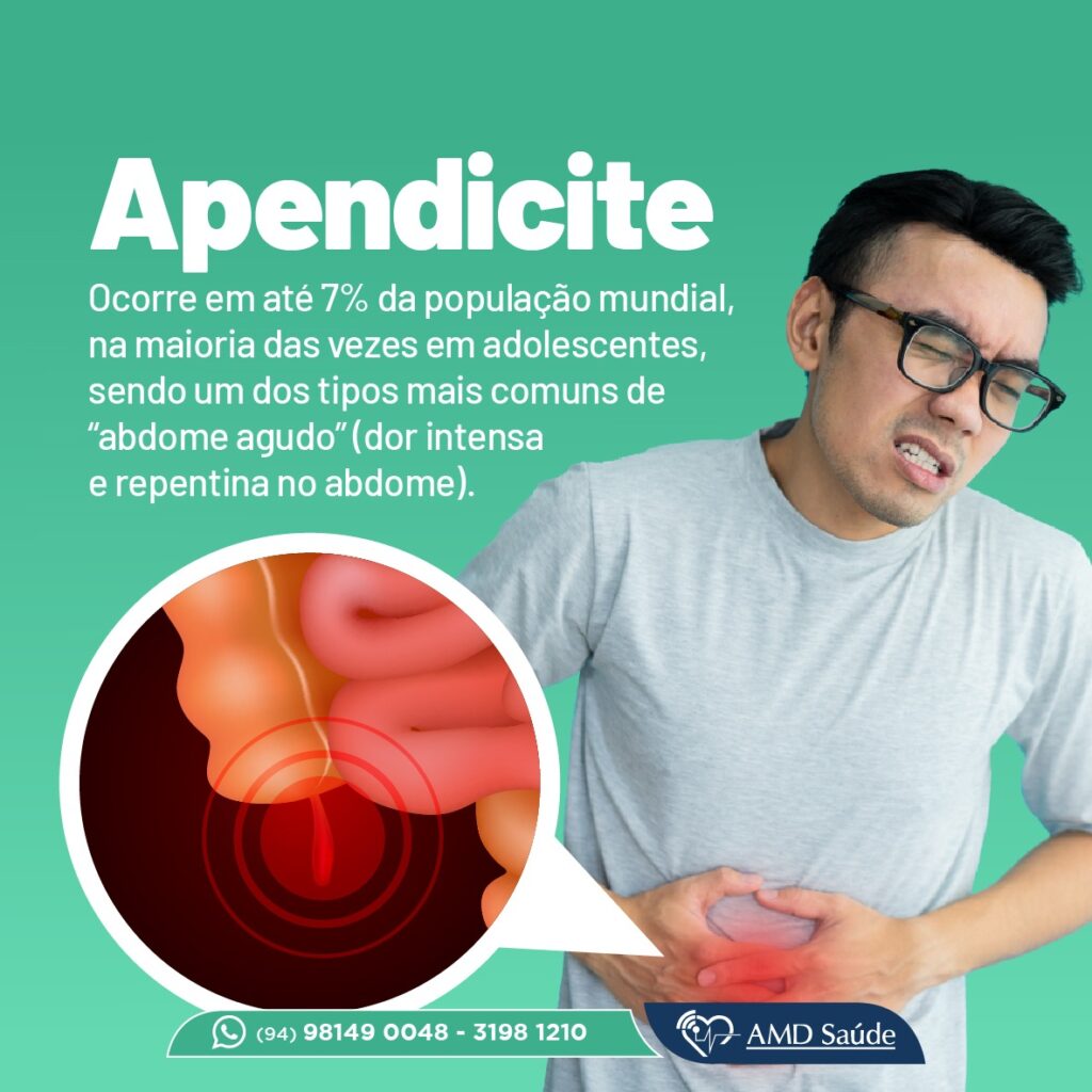 Apendicite • AMD Saúde